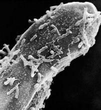 葉桿菌屬:葉桿菌屬拉丁學名(Phyllobacterium Knosel -百科知識中文網